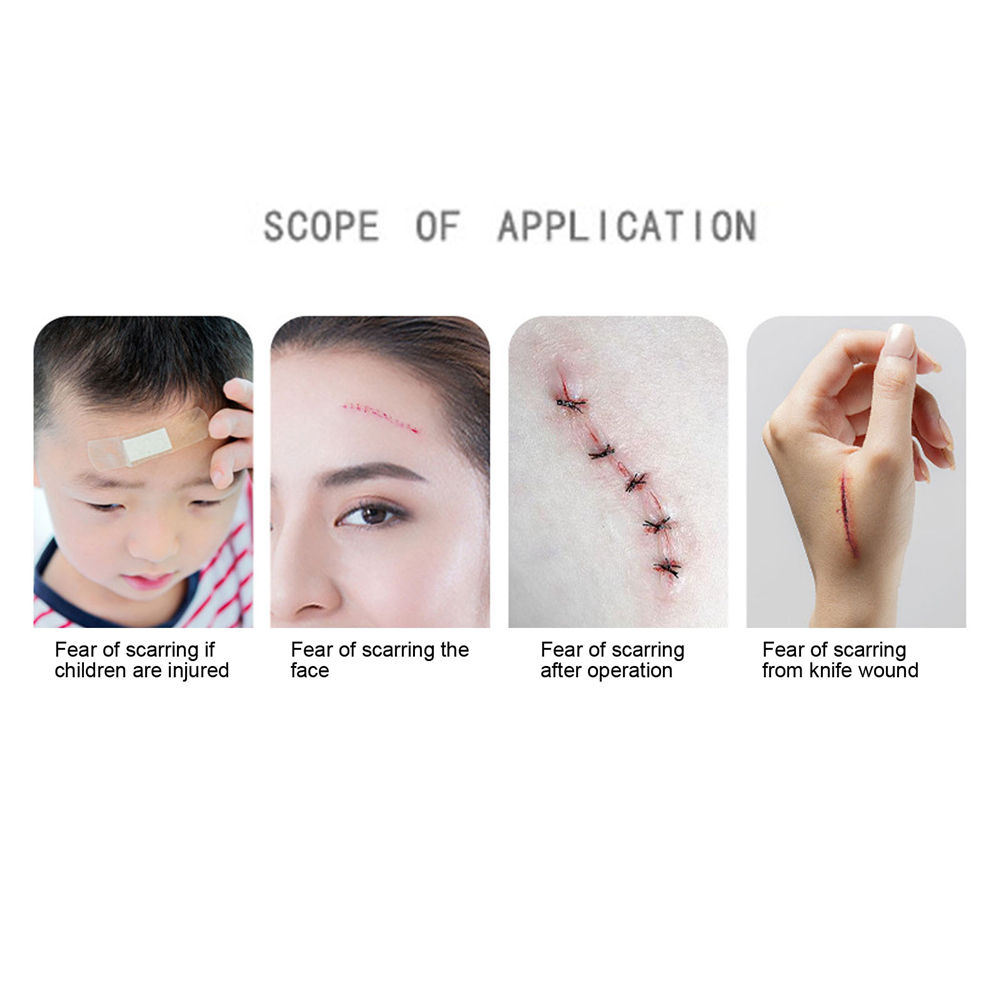 2Pcs Adjustable Zipper Bandaid Zip Stitch Sutures Adhesive Bandage ...