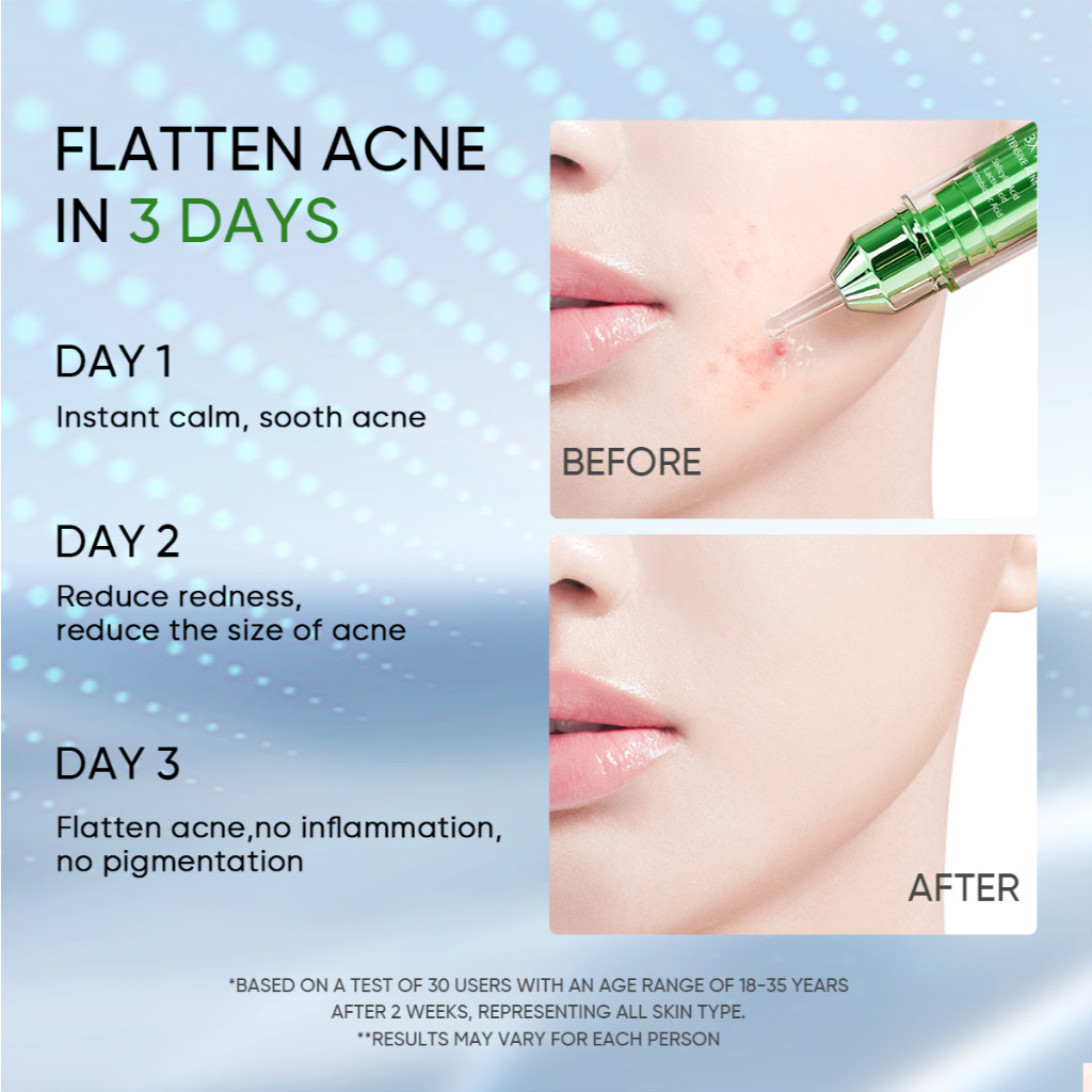 【Ship from Sabah】SKINTIFIC 3x Acid Intensive Acne Spot Gel 15ml Acne ...