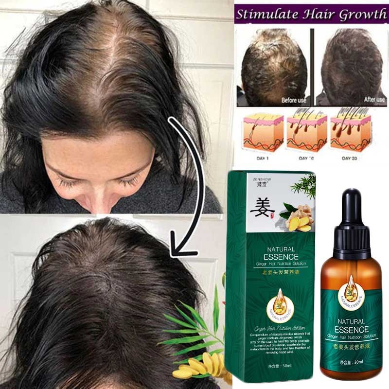 30ML ginger essential oil Hair Grow Oil Original Oil Fast Growth ...