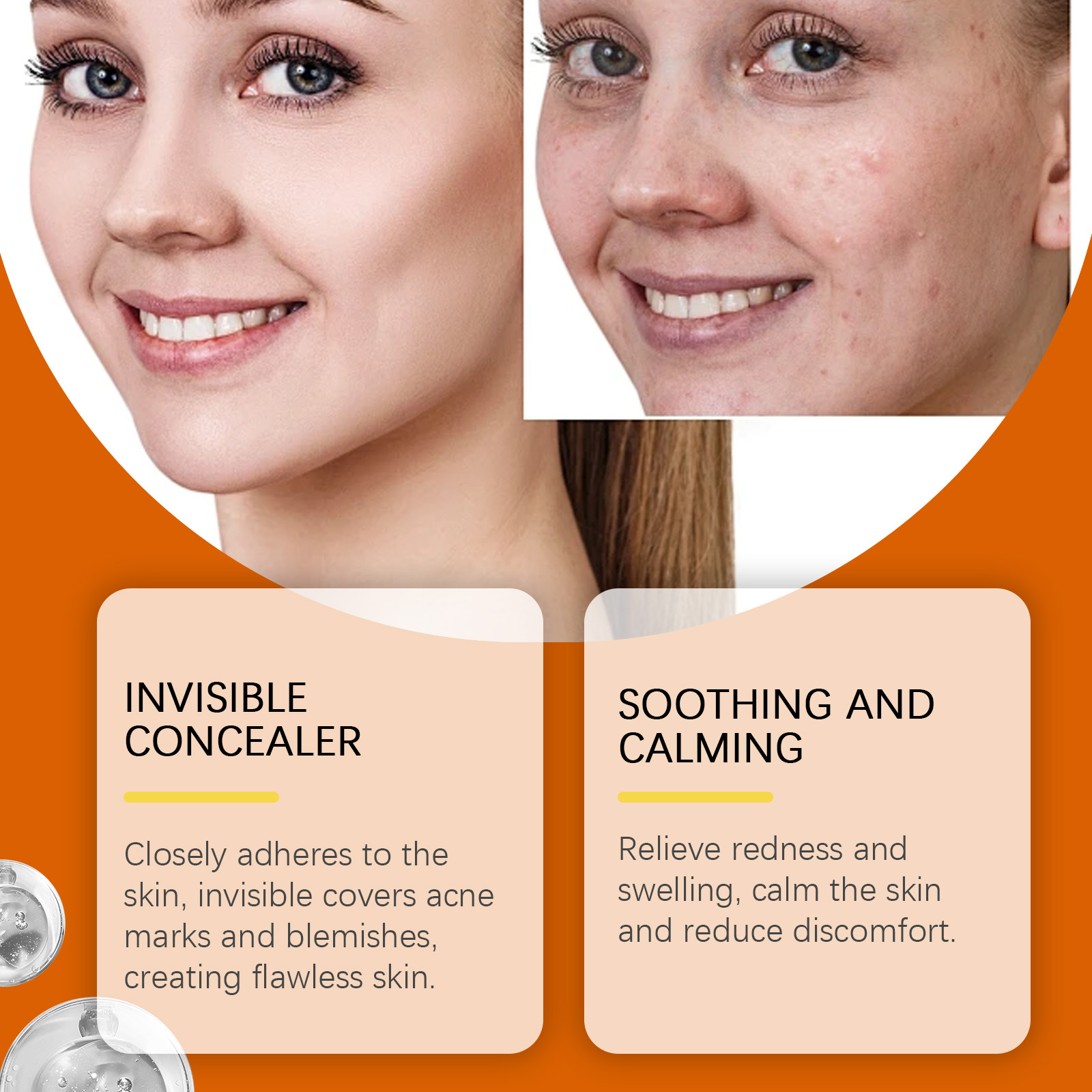 Pimple Patches For Face, Hydrocolloid Acne Patches For Covering Zits ...