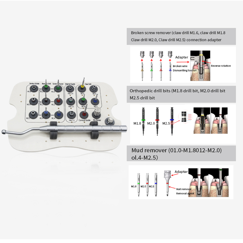 Dental Implant Broken Screw Remover Kit Reverse Drill Guide Driver SR ...