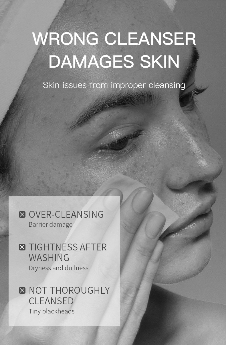 ICE LERSKIN Amino Acid Cleanser 377 Essence + Niacinamide Powerful ...