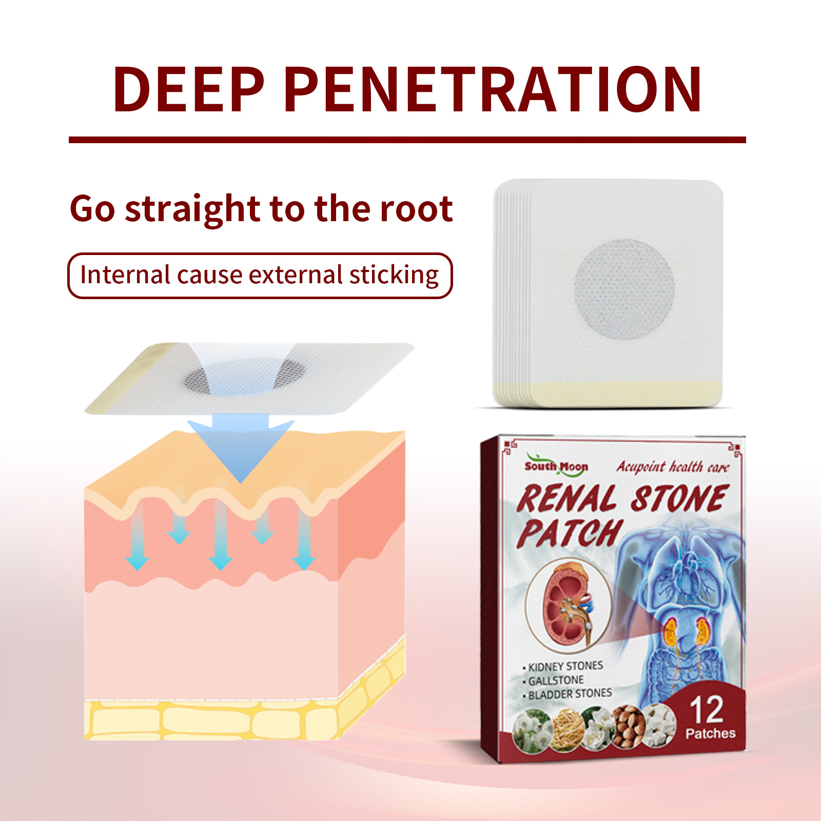 24Pcs/2box Renal Calculus Removal Plaster Treat Kidney Stones ...