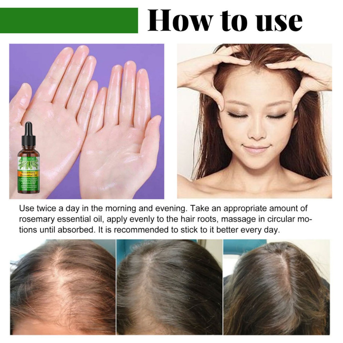 Rosemary Essential Oil for Anti-Hair Loss, Thickening, and Scalp ...