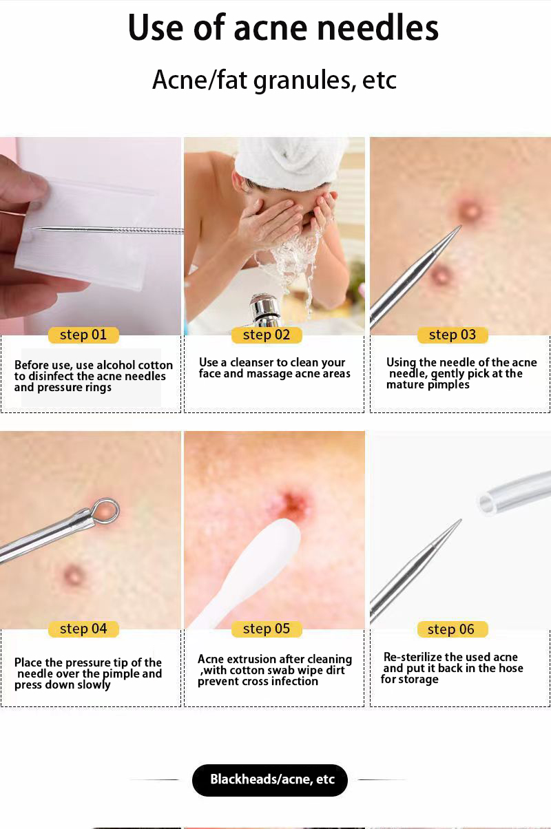 5pcs/Set Stainless Steel Acne Clip Acne Blackhead Needle | Shopee Malaysia