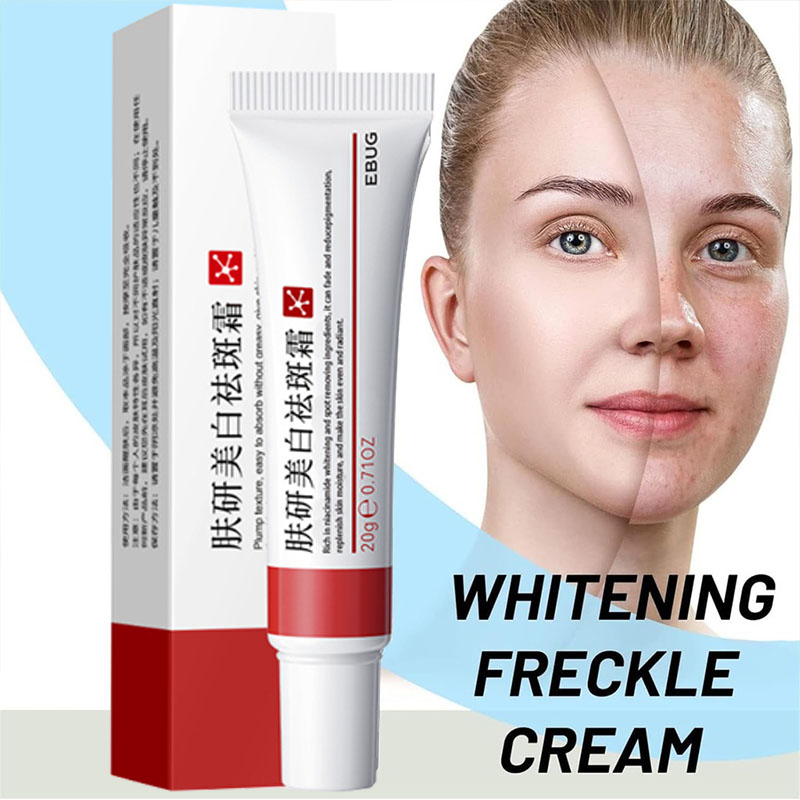 Freckle Cream, Acne Scar Removal Cream, Pigmentation Removal Cream for ...
