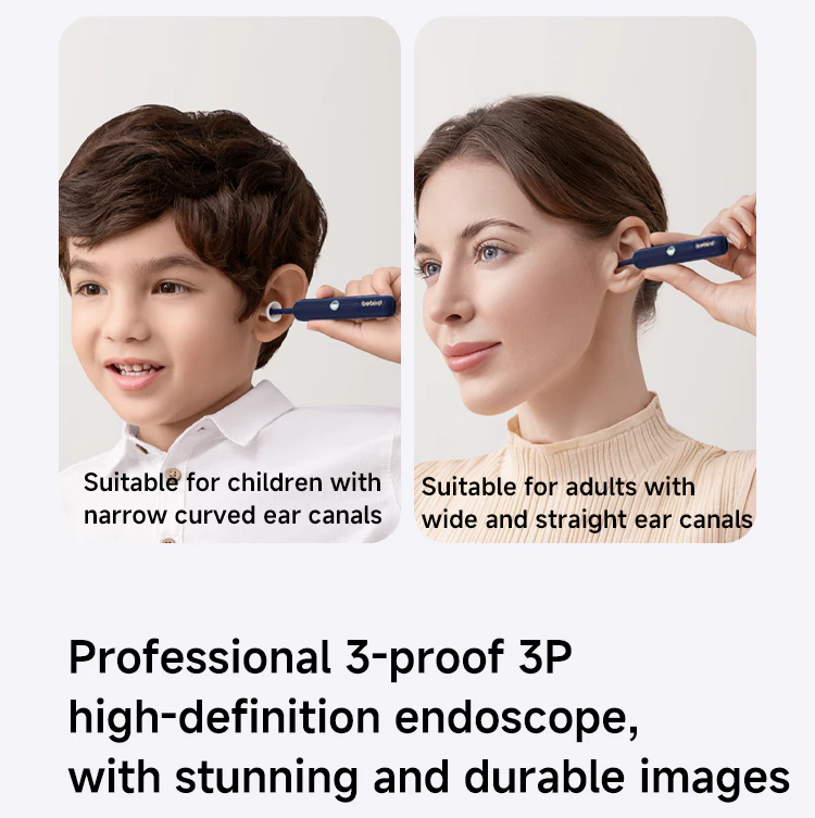 Bebird EarSight Plus Earpicks Ear Wax Removal Cleaner with tweezer 6 ...