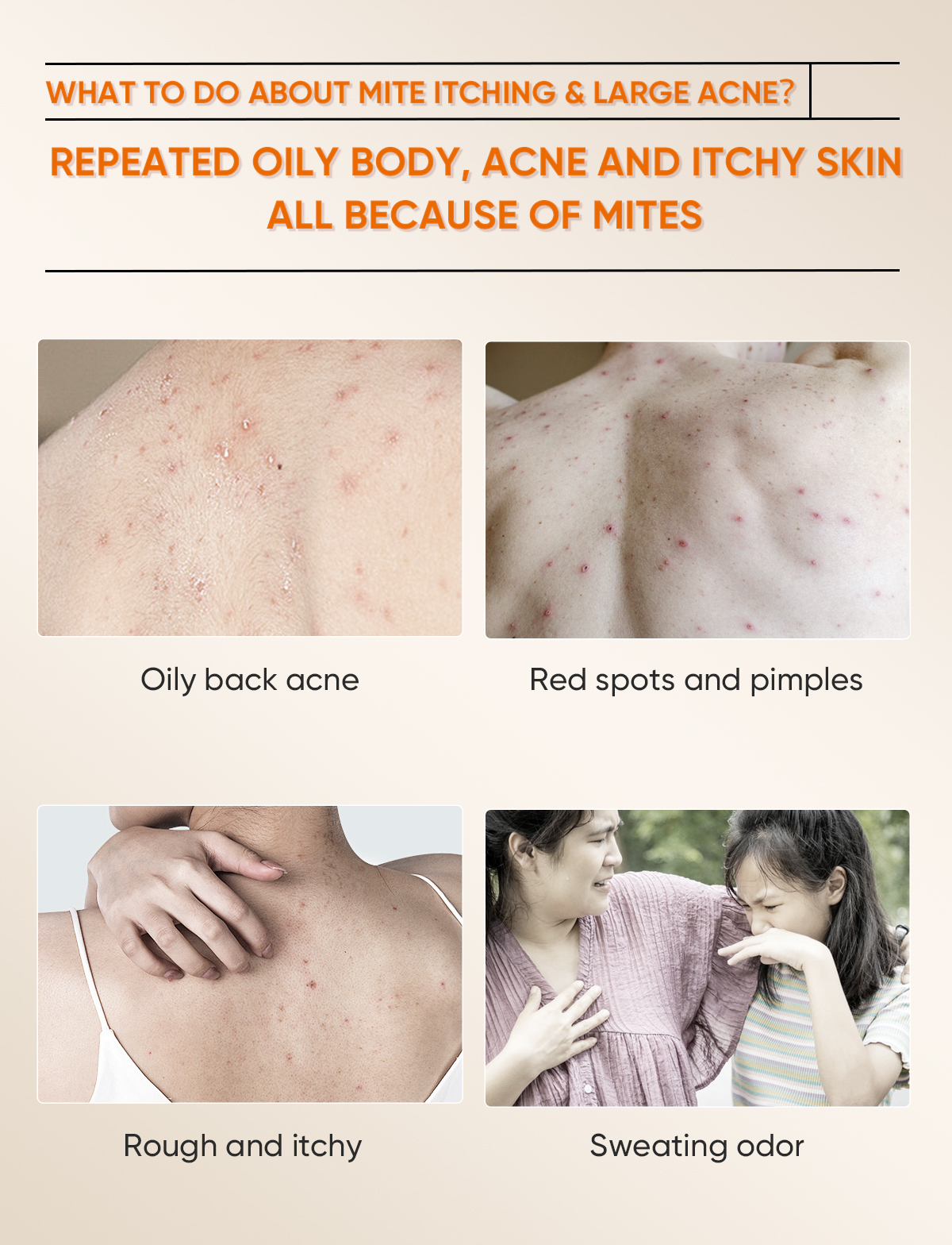 QUARXERY Body Wash Mite & Acne Cleansing Body Wash Acne Body Wash Antibacterial Anti Mite ...