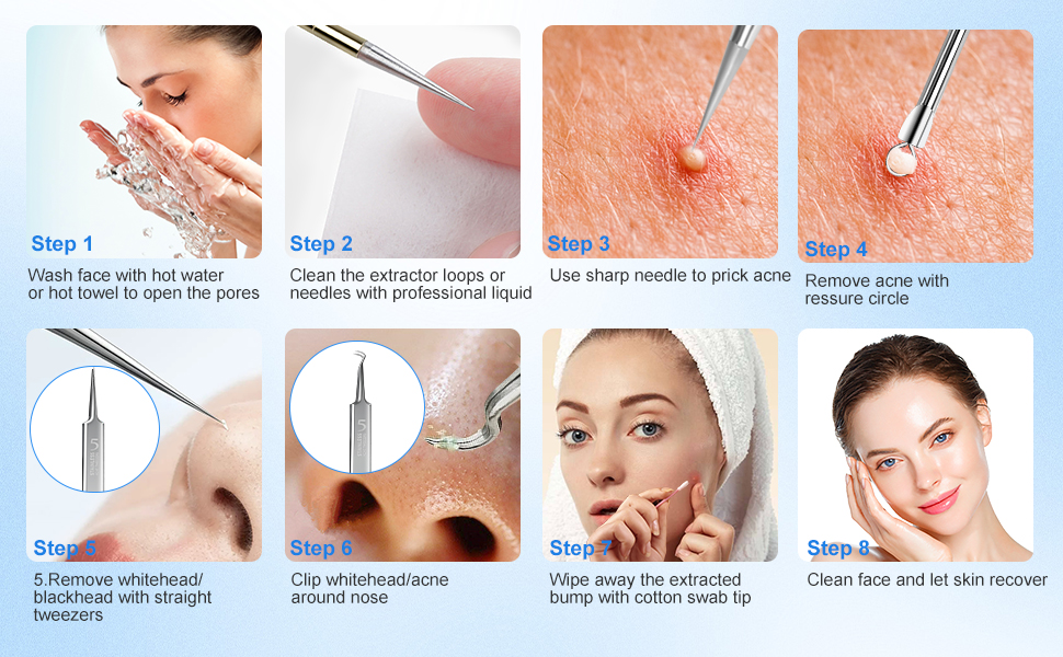 Pimple Kit Set Besi Picit Jerawat Acne Blackhead Removal Tool Needle ...