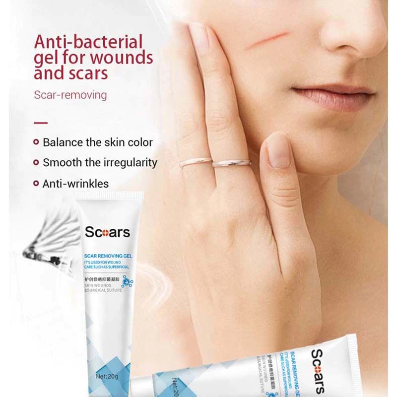 [Buy 2 get 1 free] ubat hilangkan parut bekas luka bakar, bekas gigitan ...
