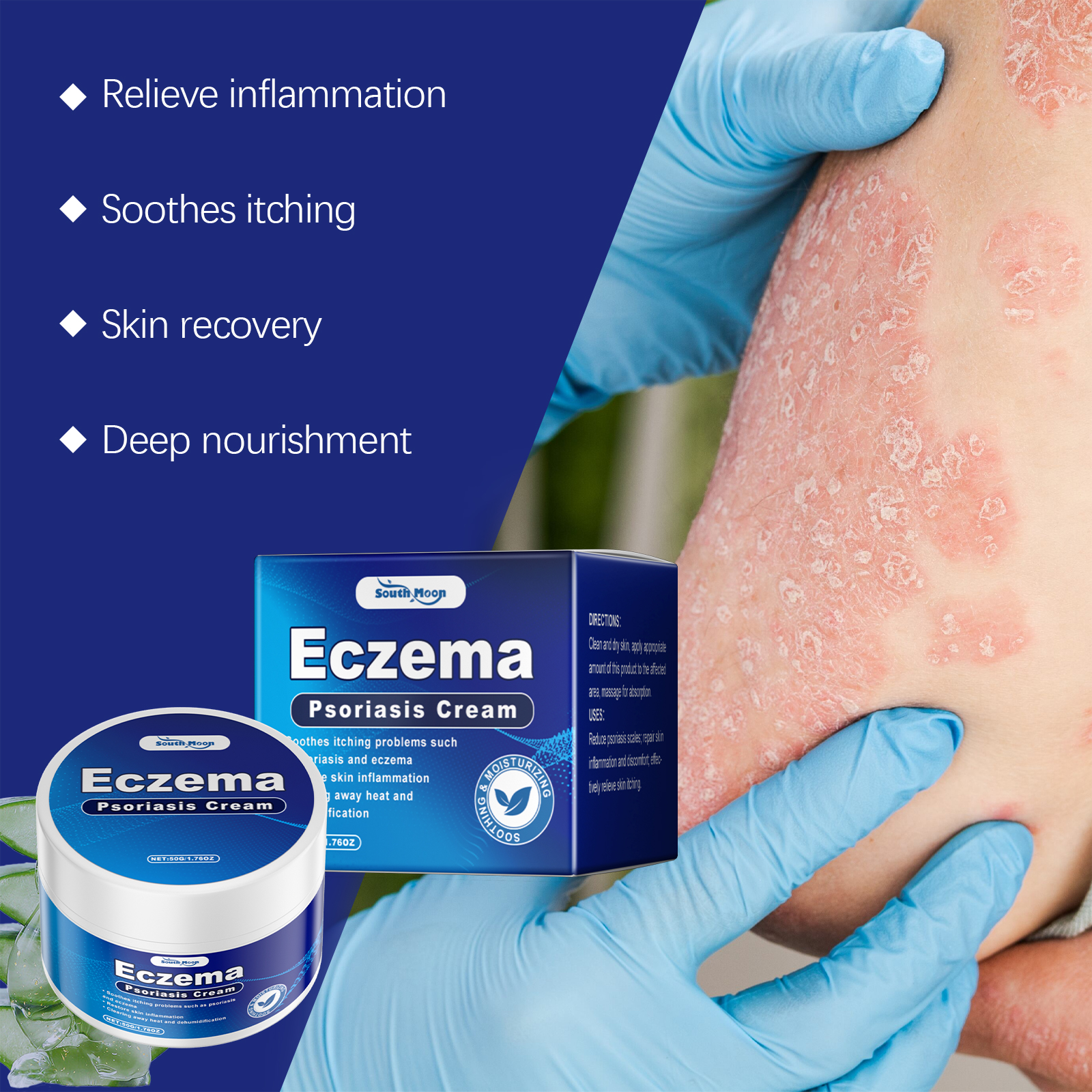 South Moon Eczema Cream Psoriasis Cream Krim Gatal Ubat Gatal kulit ...