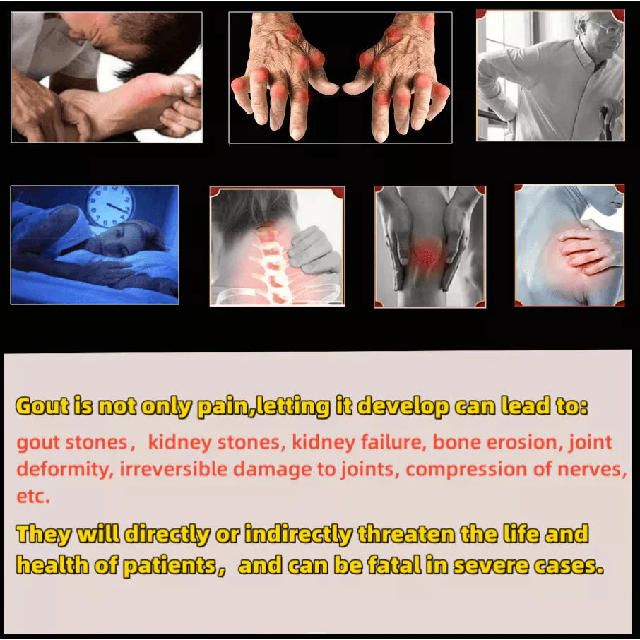 “COD” [JAPAN] Gout Patch, Gout, Arthritis, Joint Pain, Swelling, 12 ...