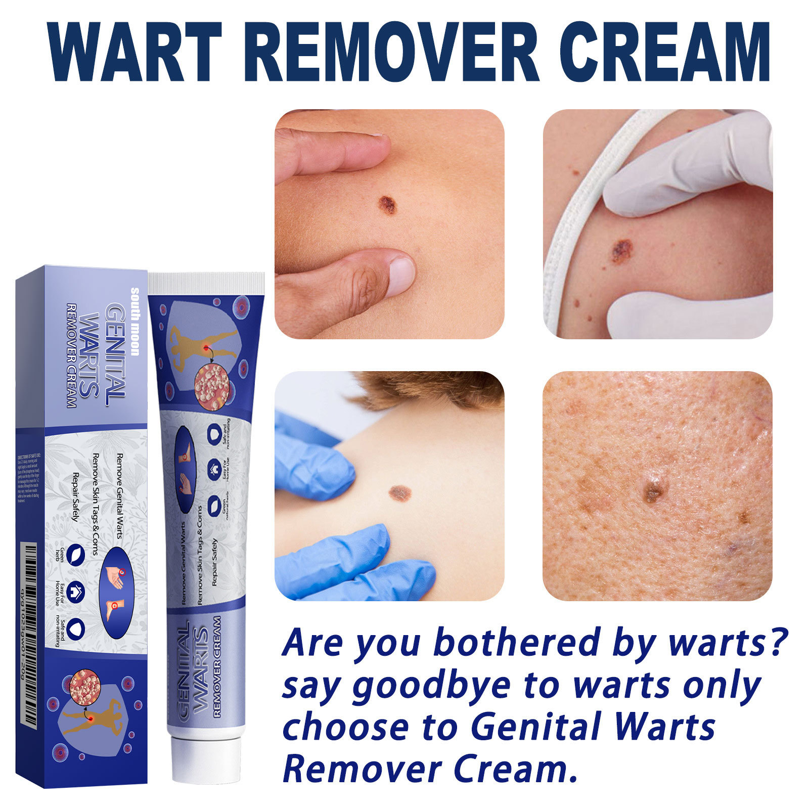 【Fast Effective 】Ubat buang kutil ketuat tahi lalat biji Mole Removal ...
