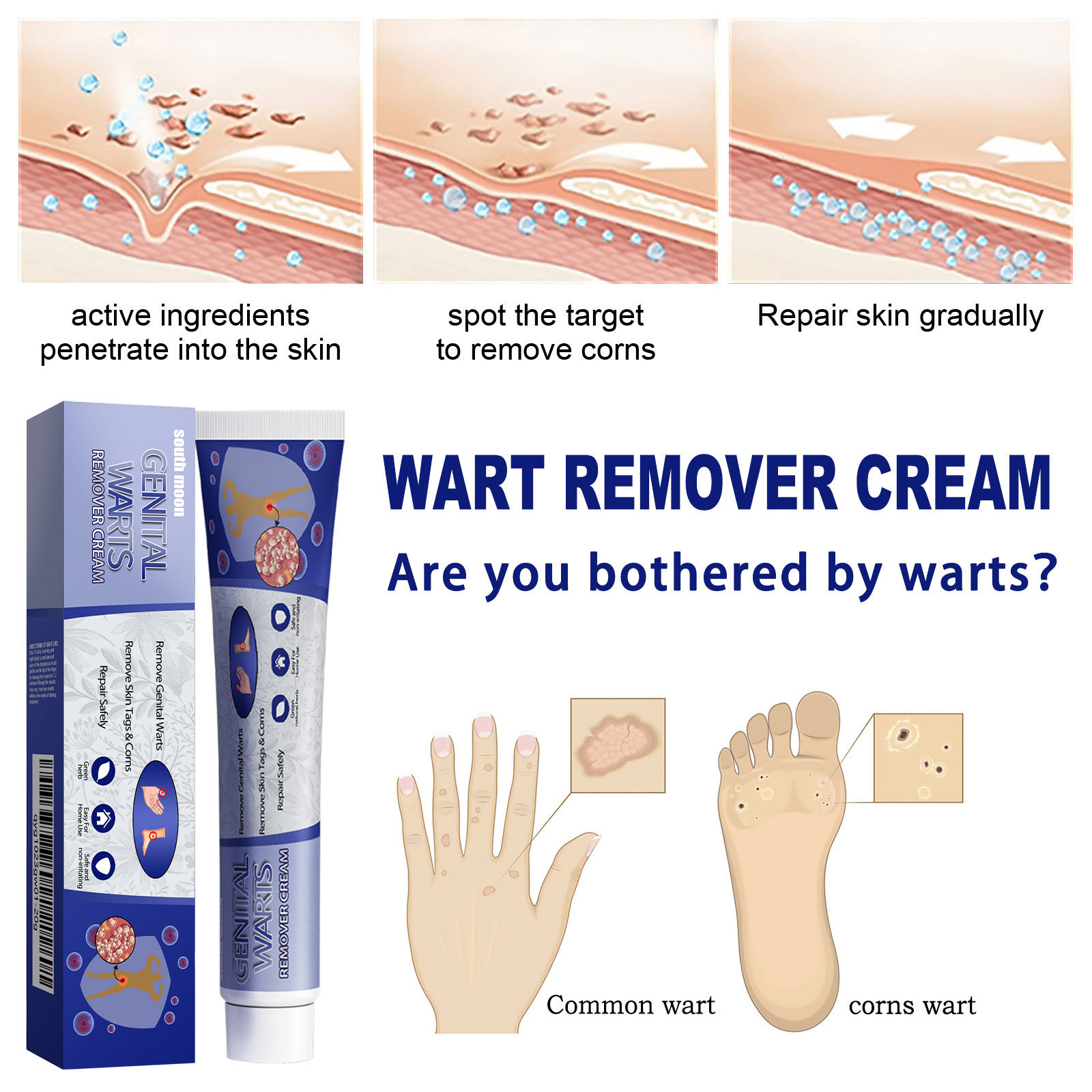 【Fast Effective 】Ubat buang kutil ketuat tahi lalat biji Mole Removal ...