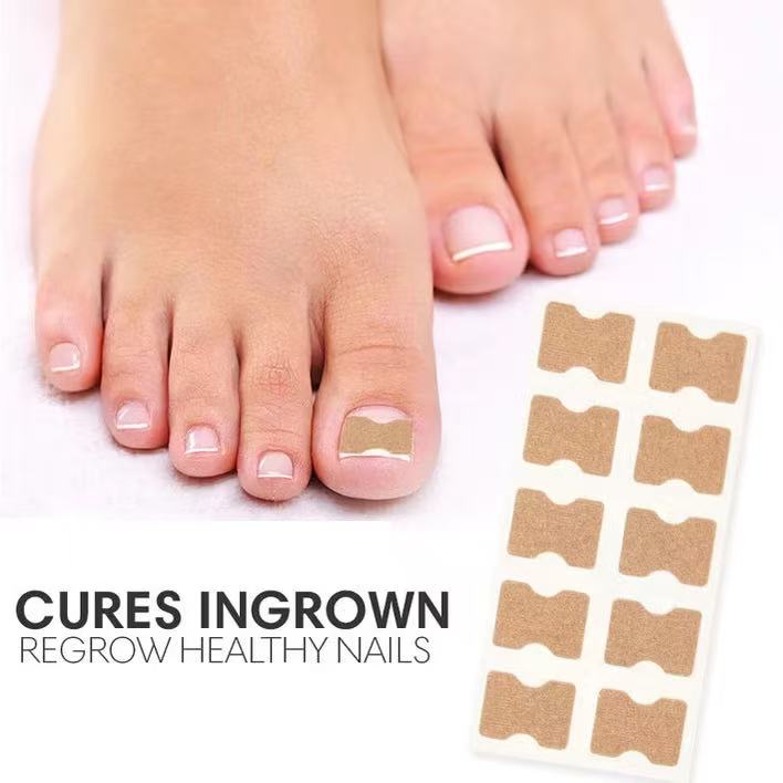 40 Pack Ingrown Toenail Correction Strips Nail Fixing Patches for ...