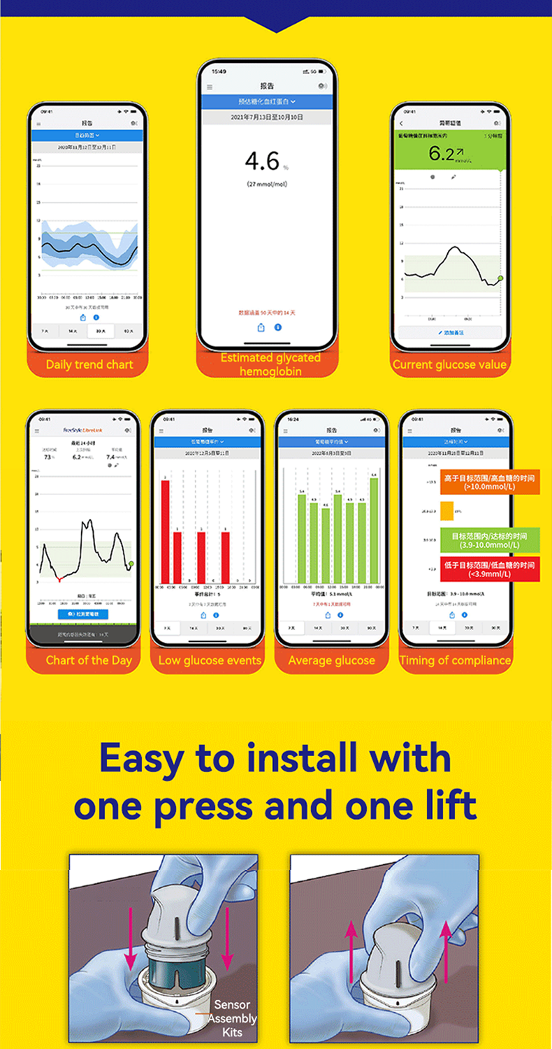 ABBOTT Freestyle Libre 2 iCGM 24H Realtime Glucose Monitoring Free ...