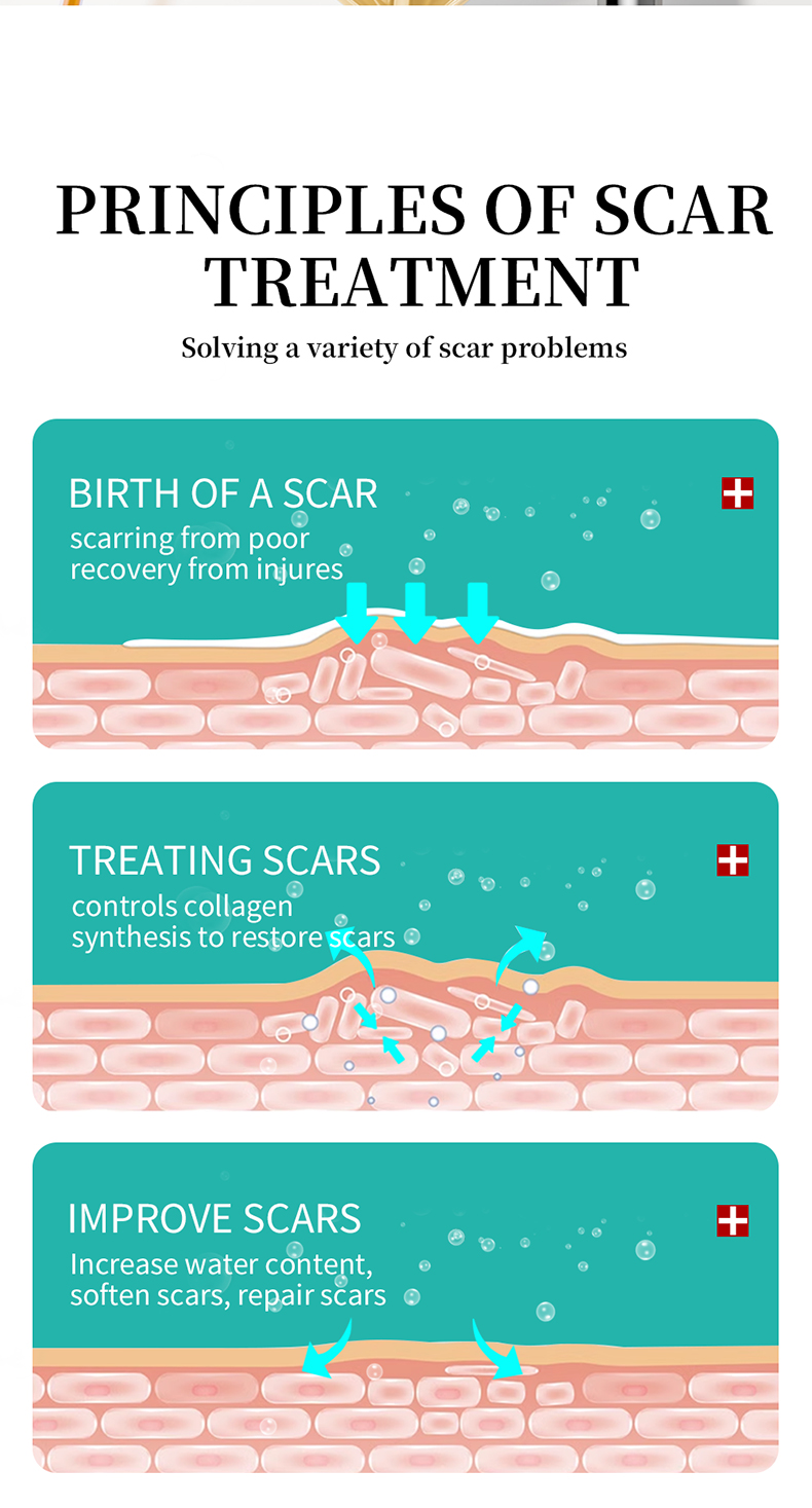 Scar Cream for Reducing and Repairing Scars on Face and Body ...