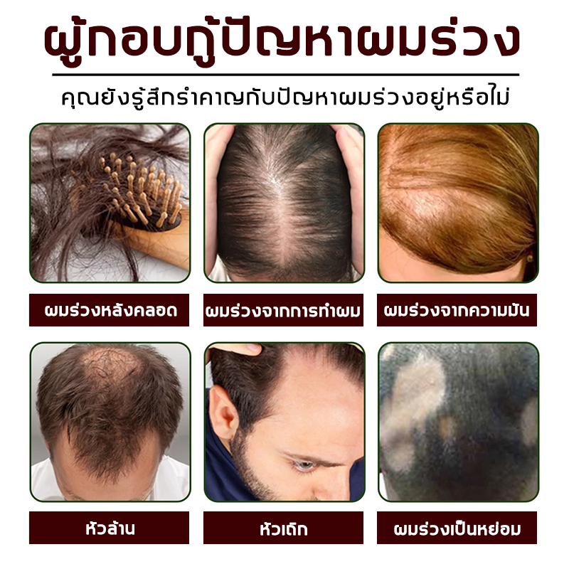 Hair Growth Spray, Fast Hair Growth Spray, Rapid Hair Growth, Anti-Hair ...