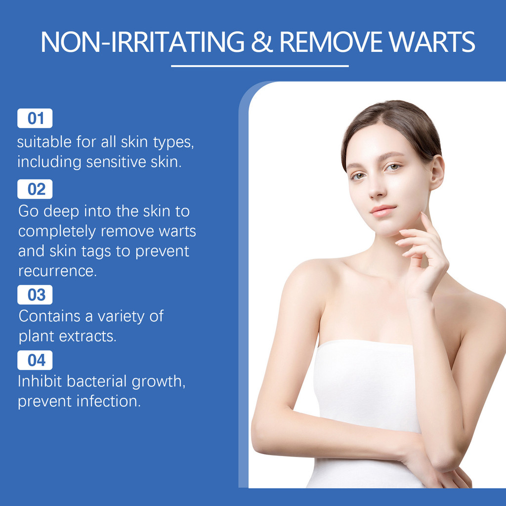 Warts Remover Ointment Wart Treatment Cream Skin Tag Warts Remover ...