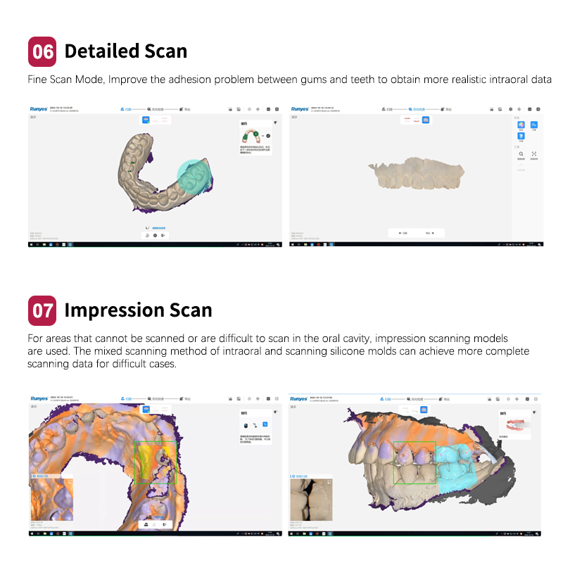 Dental Intraoral Scanner Runyes 3DS V5 AI Scan Digital Solution Digital ...