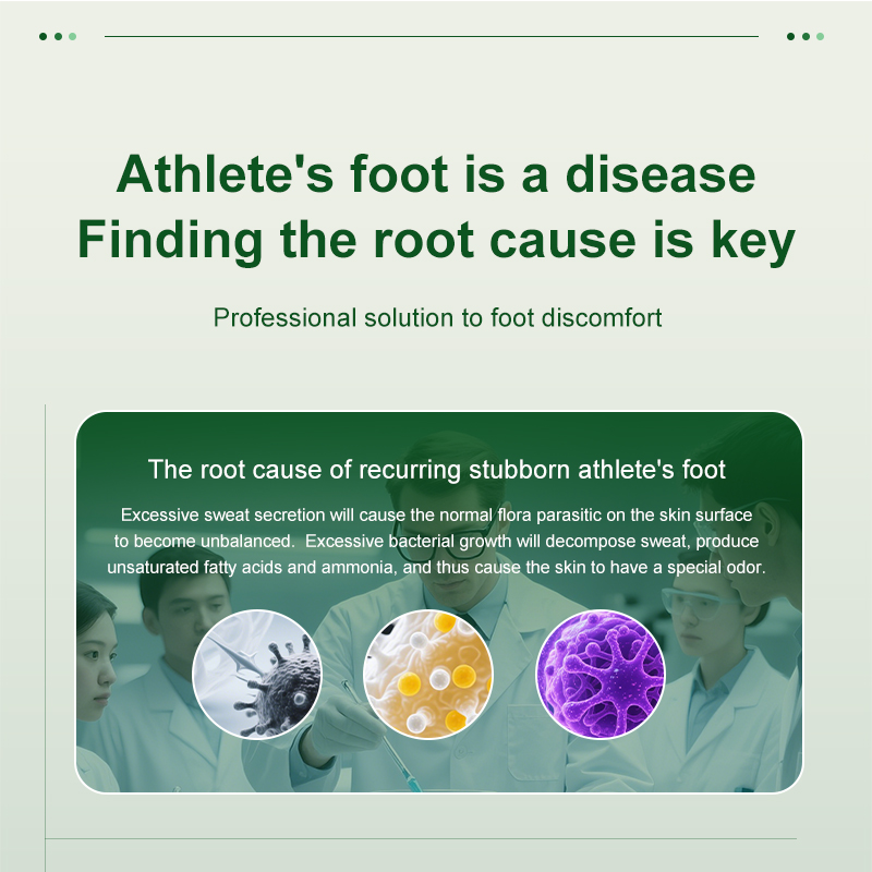 Antifungal foot spray Foot deodorant Fungal infection/athlete's foot ...