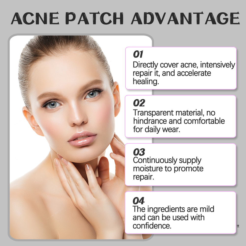 288PCS Pimple Patches for Face, Hydrocolloid Acne Patches for Covering ...
