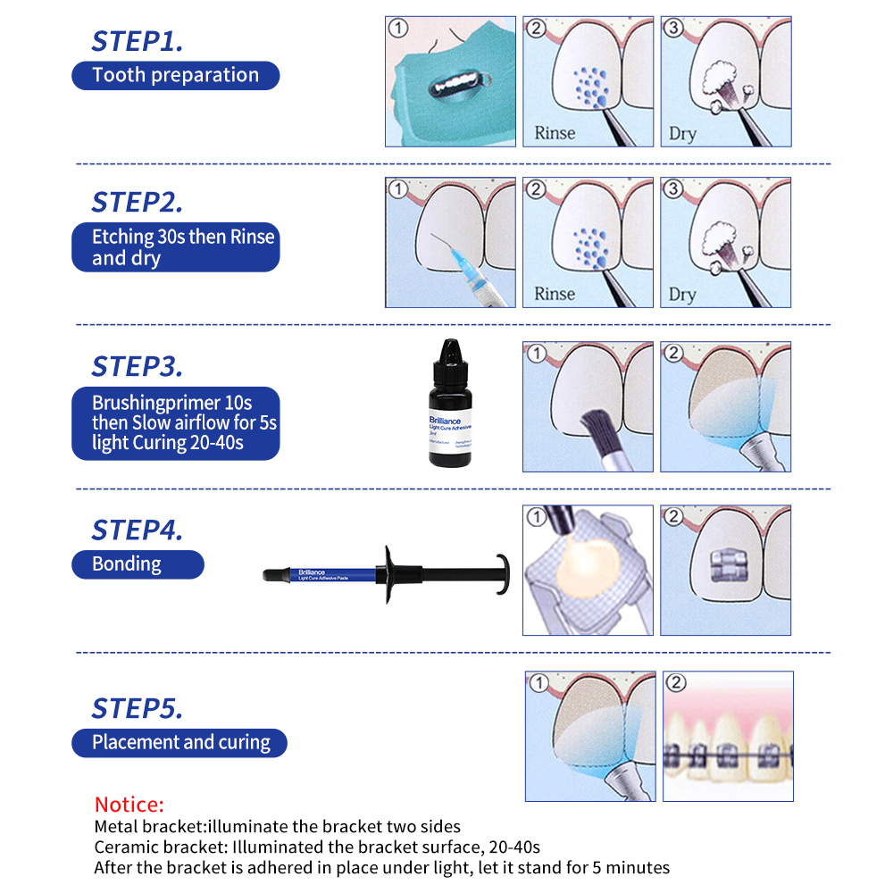 Dental Orthodontic Light-cure Adhesive Full Kit Adhesive Bondable Glue ...