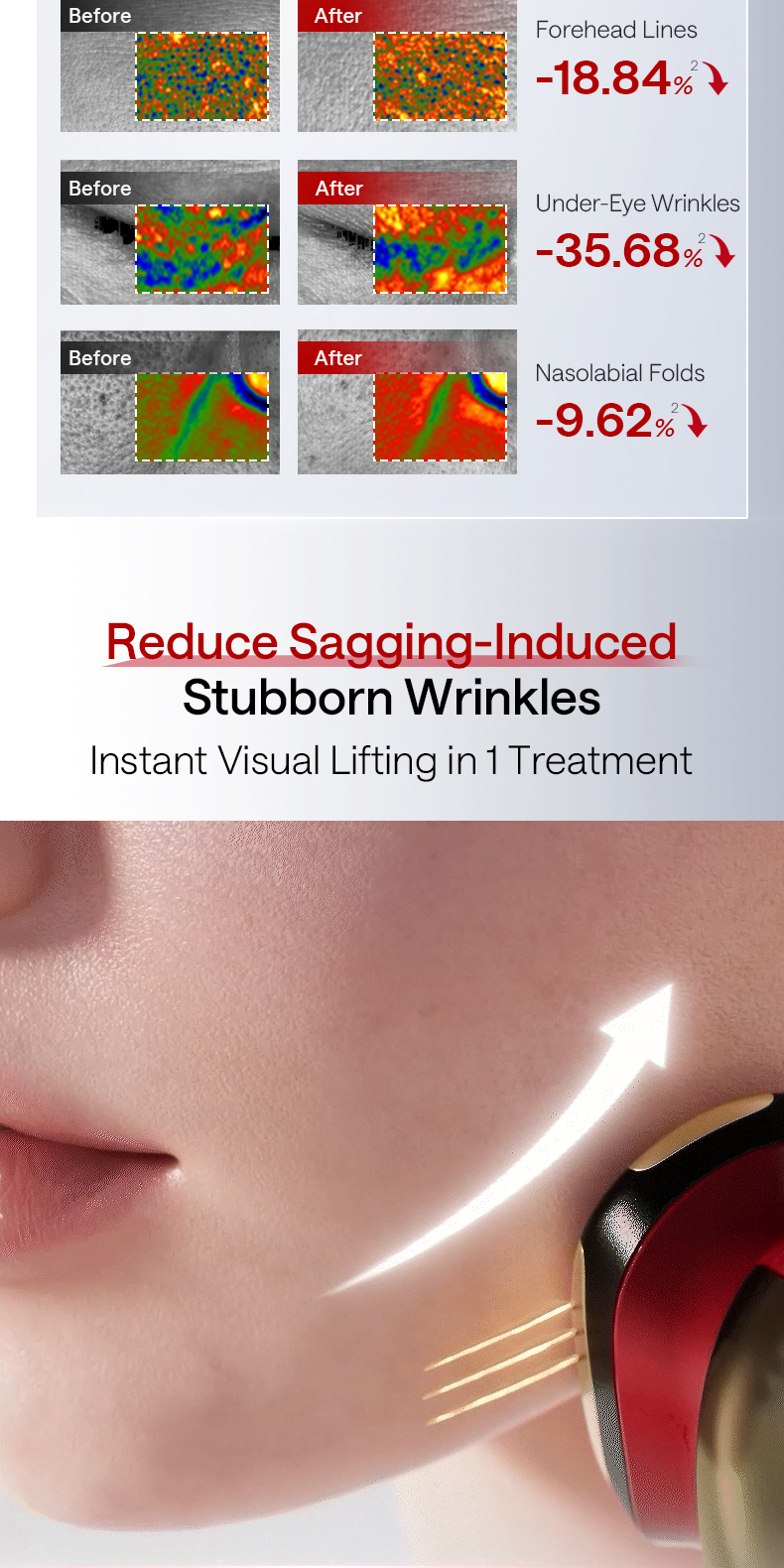 【Kankankan Exlusive】Jmoon M30 MAX Collagen Cannon Max 【MY Shipping + 1 ...