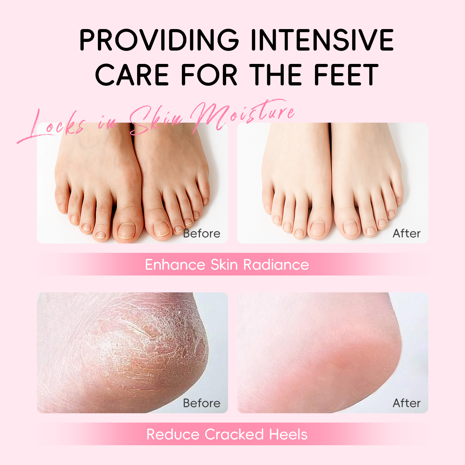 LAIKOU Japan Sakura Heel Stick Vitamin E Non-Greasy Long-Lasting ...