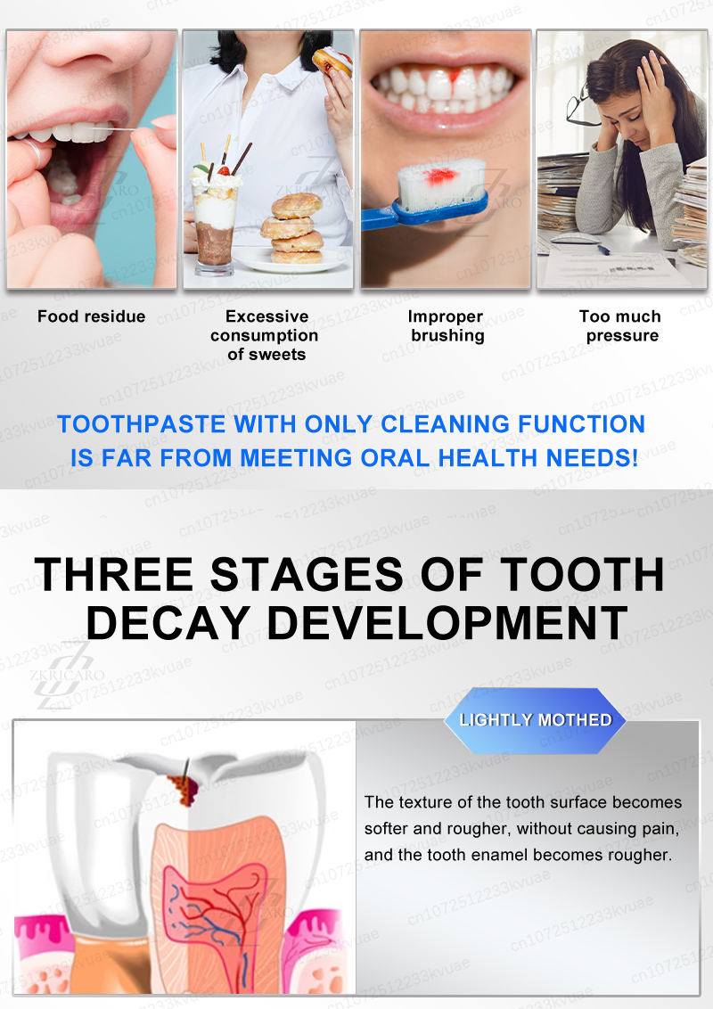 Fluoride toothpaste, Prevent tooth decay,Filling tooth decay, Fill ...