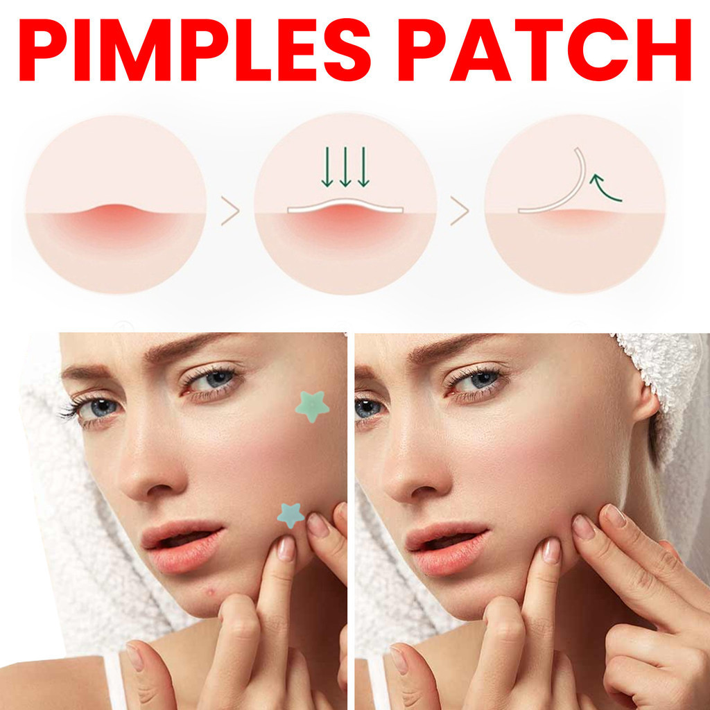 200 Colorful Star-shaped Hydrocolloid Patches for Effective Acne and ...