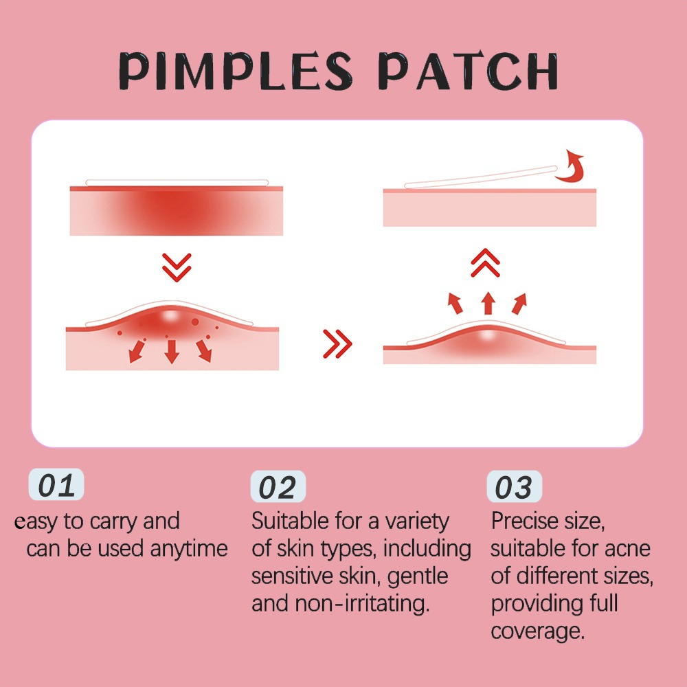 280/560pcs Hydrocolloid Acne Patches to Cover Pimples and Skin ...