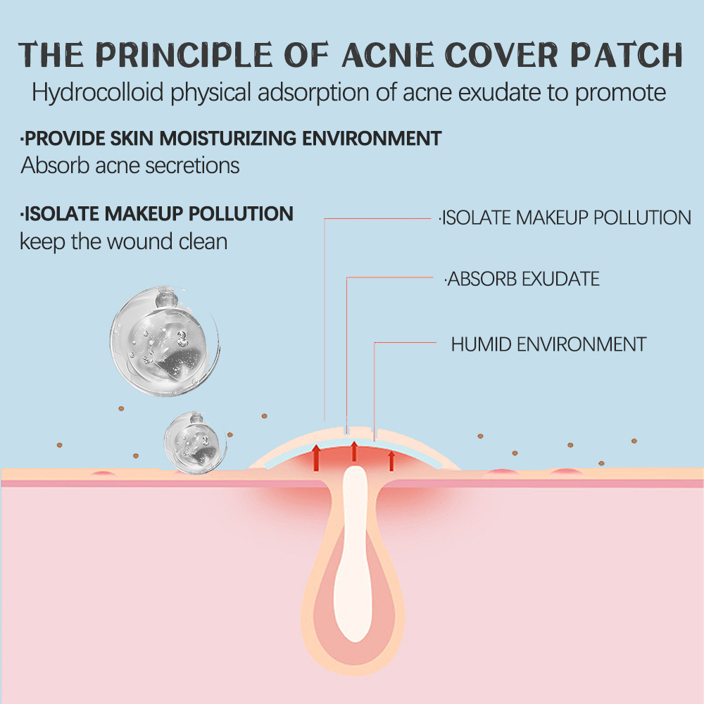 280/560pcs Hydrocolloid Acne Patches to Cover Pimples and Skin ...