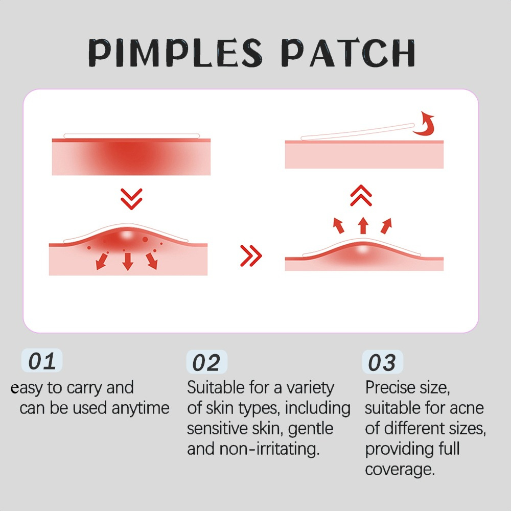 420/840pcs Cute Hydrocolloid Acne Patches to Cover Zits and Blemishes ...