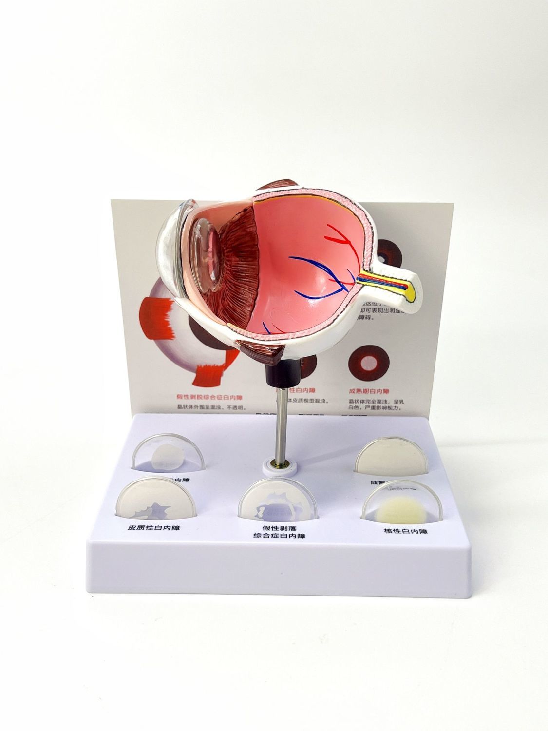 Cornea Eyeball Model Human Eye Model Human Eye Demonstration Teaching ...