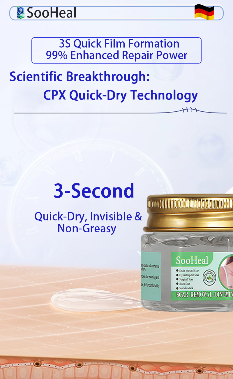 scar removal cream 祛疤膏 Krim parut 15g For Burns, Surgical Scars ...