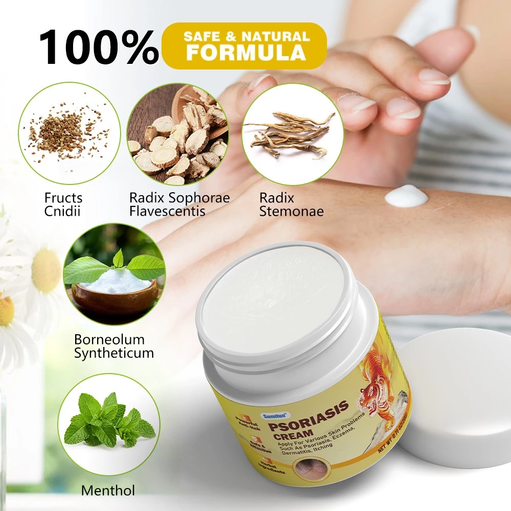 Ubat gatal Ubat kurap Psoriasis cream 20g Anti-Itch Remover Itchy Skin ...