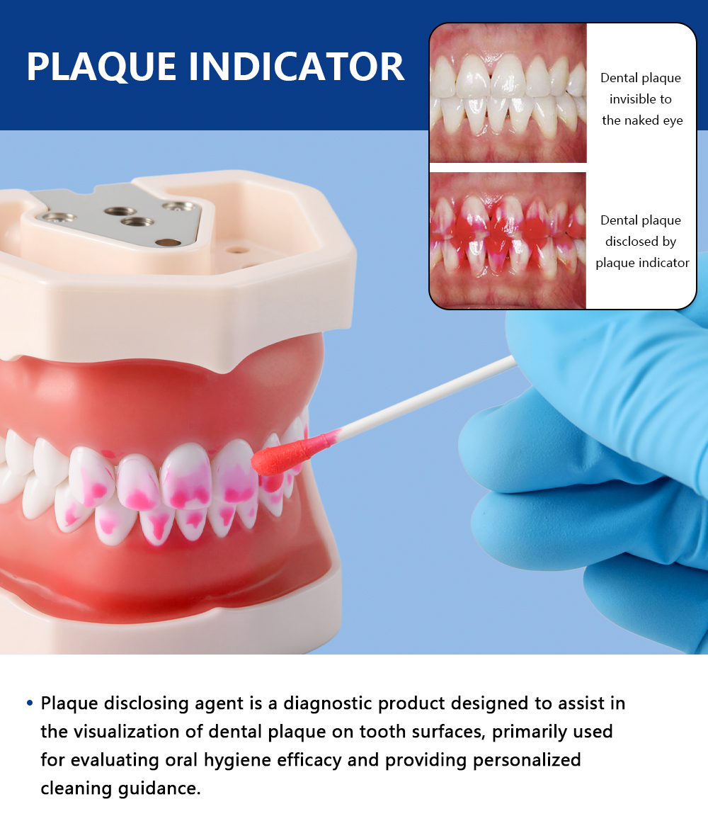 Plaque Disclosing Agent Oral Tartar Test Examination Dental Plaque ...
