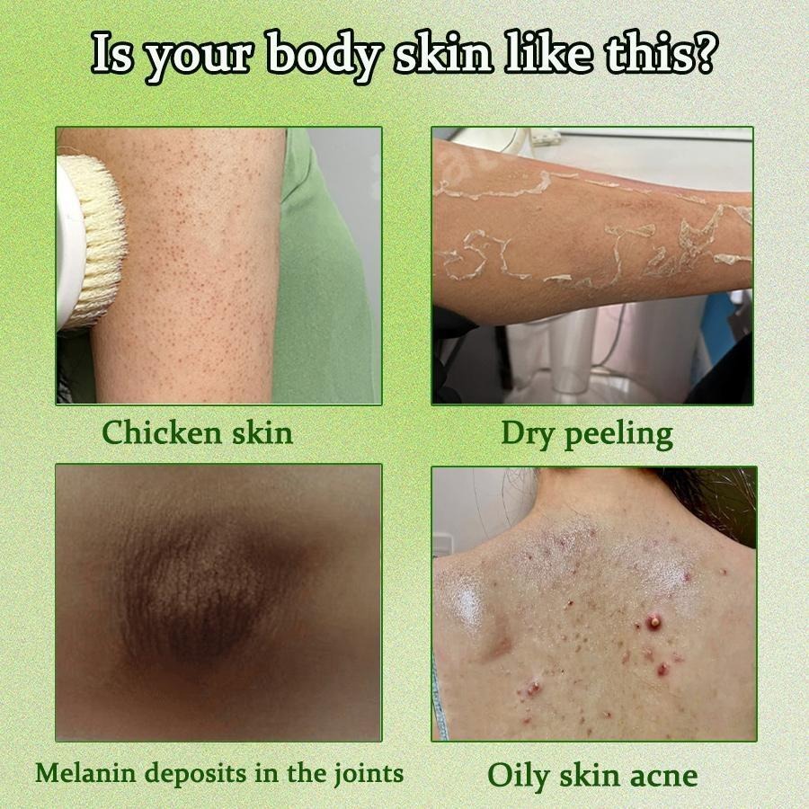 body scrub exfoliate Deep Cleansing Exfoliating Chicken Skin ...