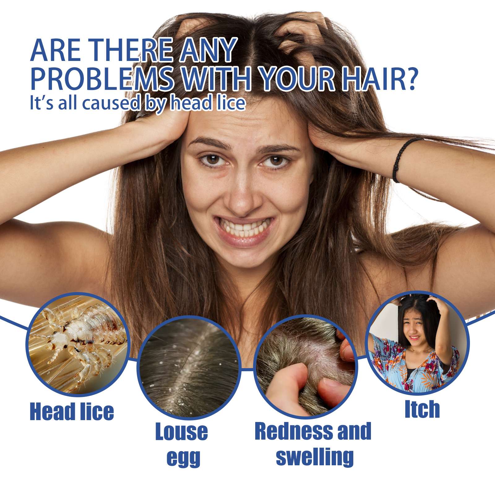 South Moon Scabies & Lice Spray eliminates head lice, pubic lice, fleas ...