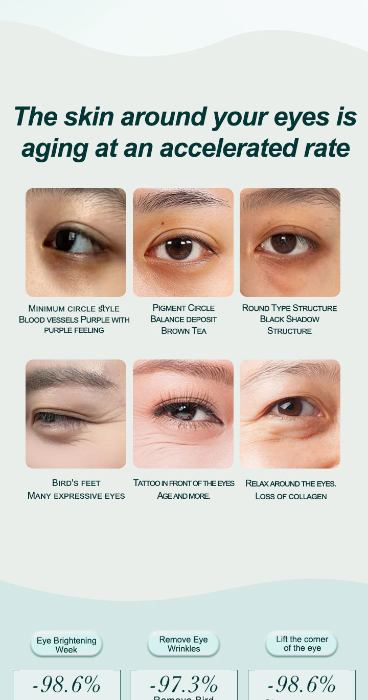 PORCOPE Eye Cream Anti-Dark Circle Lifts Firms Hydrating & Soothing ...