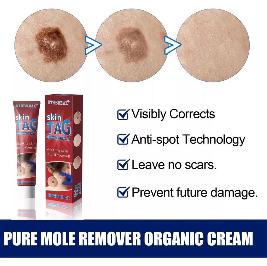 Ethereal Wart Remover Cream Fast Acting Herbal Ointment for Warts ...