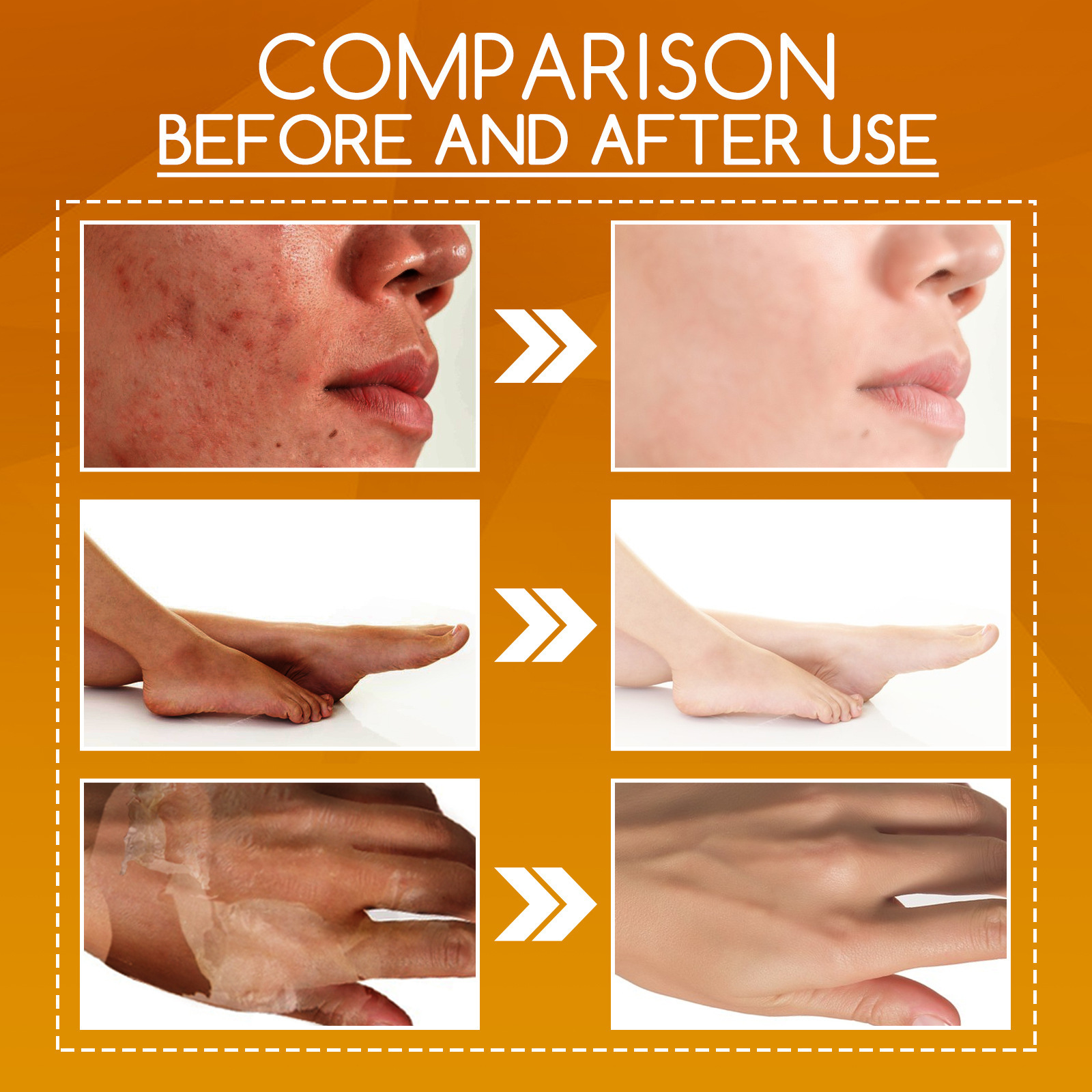 Yellow Peeling Oil Bleaching Face Body Dark Skin Brighten Whiten Lotion ...