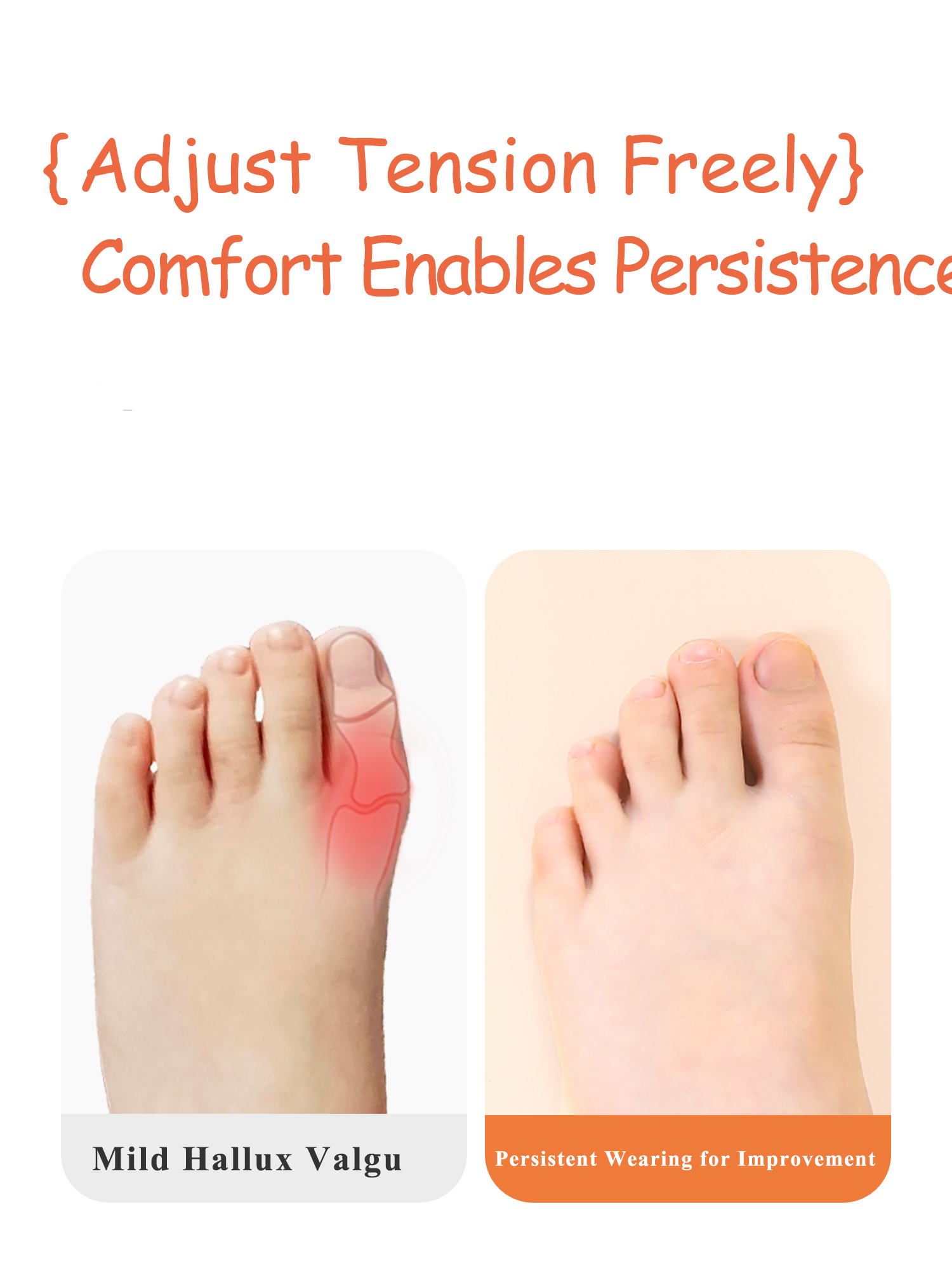 Eaden Kids Bunion Relief Night Time Bunion Splint Adjustable Hammer Toe ...