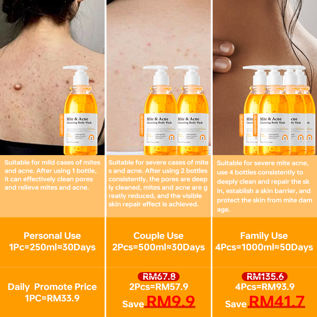 [Remove Mites And Relieve Itching] QUARXERY Anti Mite And Acne Body ...