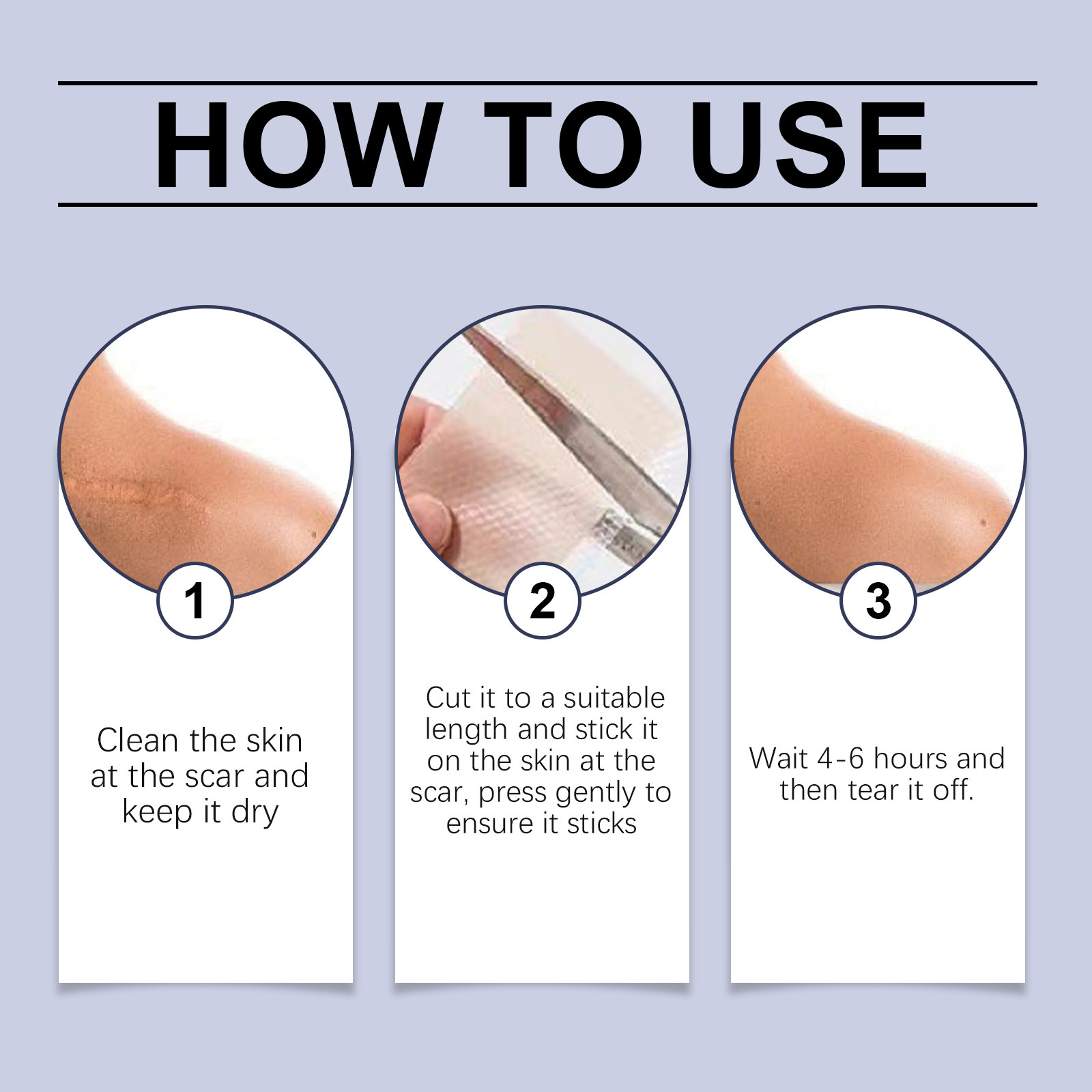 Ingrown Toenail Corrector Patch, Nails Nursing Extra Strength, Toenails ...