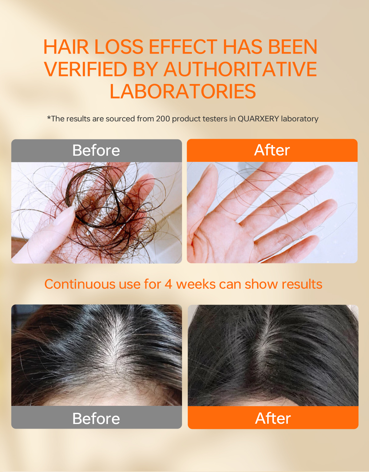 Quarxery Oil Control Shampoo Ginger Root Extract Protect Hair Anti Hair ...