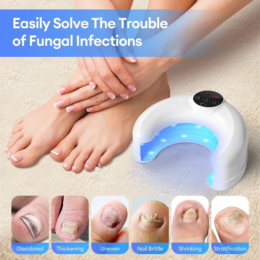 Wireless Nail Fungus Laser Device 45W 14pcs 470nm Blue Light 3-10 ...