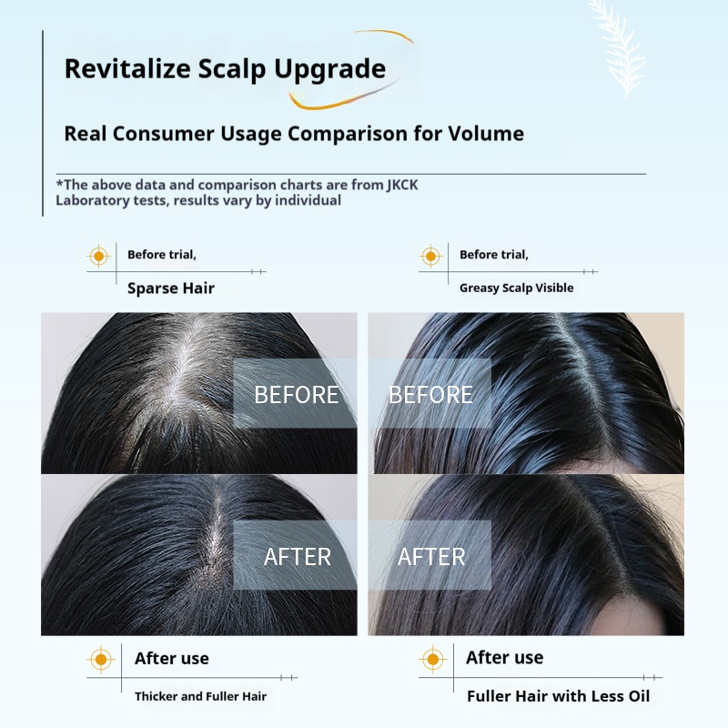 JKCK Syampu Anti Kelemumur & Kawalan Minyak - Rambut Ringan dan Gebu ...