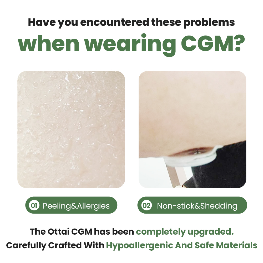 Ottai Hypoallergenic Version CGM Continuous Glucose Monitoring System ...